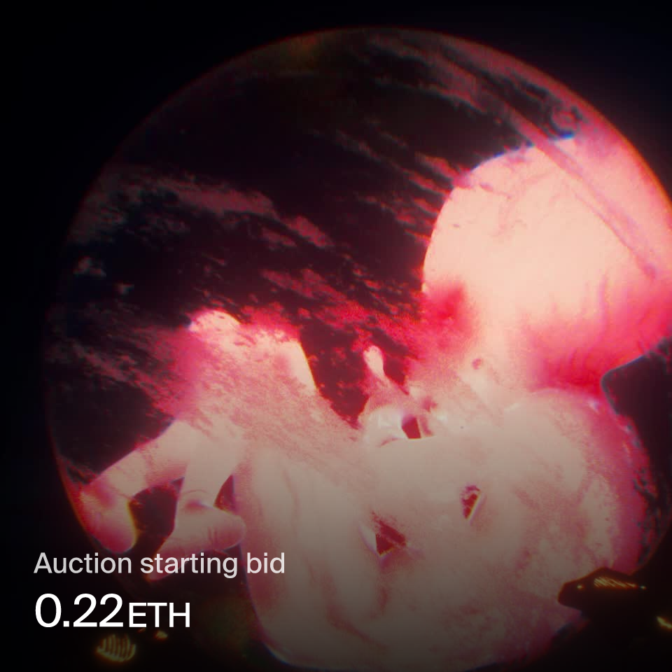 Alien Fetus | Foundation